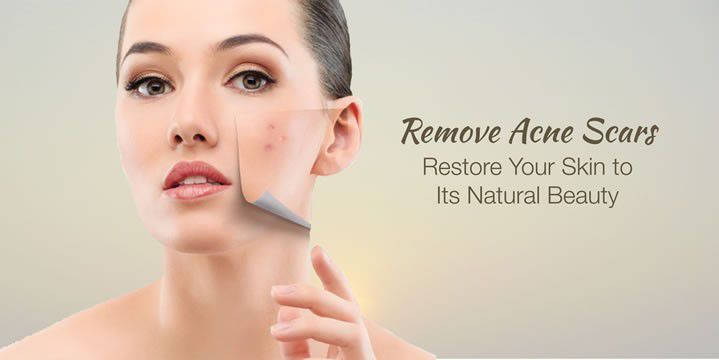 Zelfina Skin Cream What Is A Good Skin Care Cream Homify